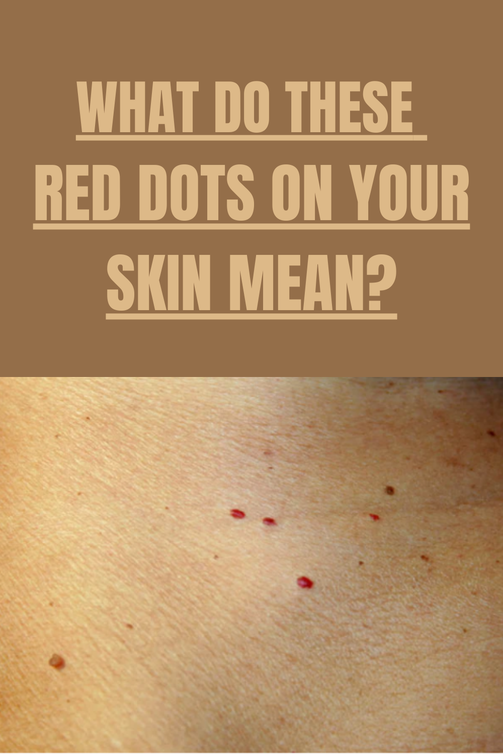 What Do These Red Dots On Your Skin Mean? - Daily Gardening Mag