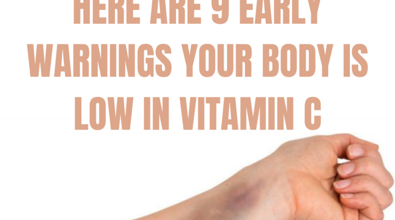 Lack of Vitamin C May Cause Serious Health Issues. Here are 9 Early ...