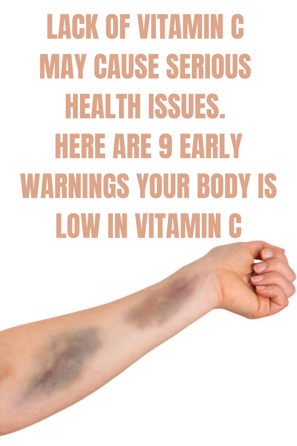 Lack of Vitamin C May Cause Serious Health Issues. Here are 9 Early ...