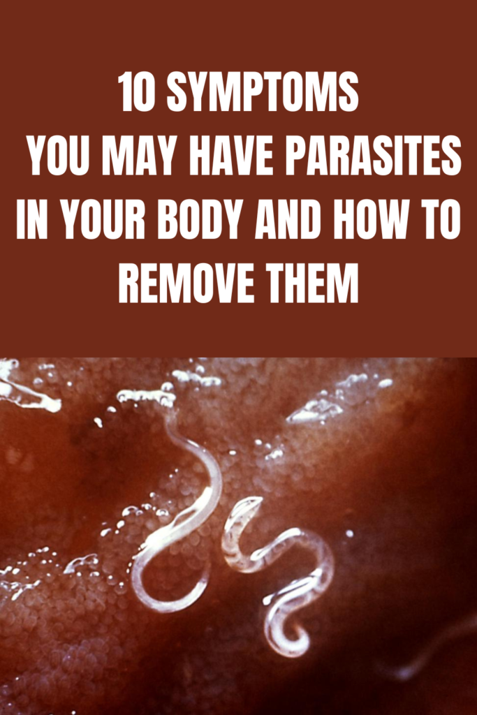 10 Symptoms You May Have Parasites in your Body (and how to remove them ...