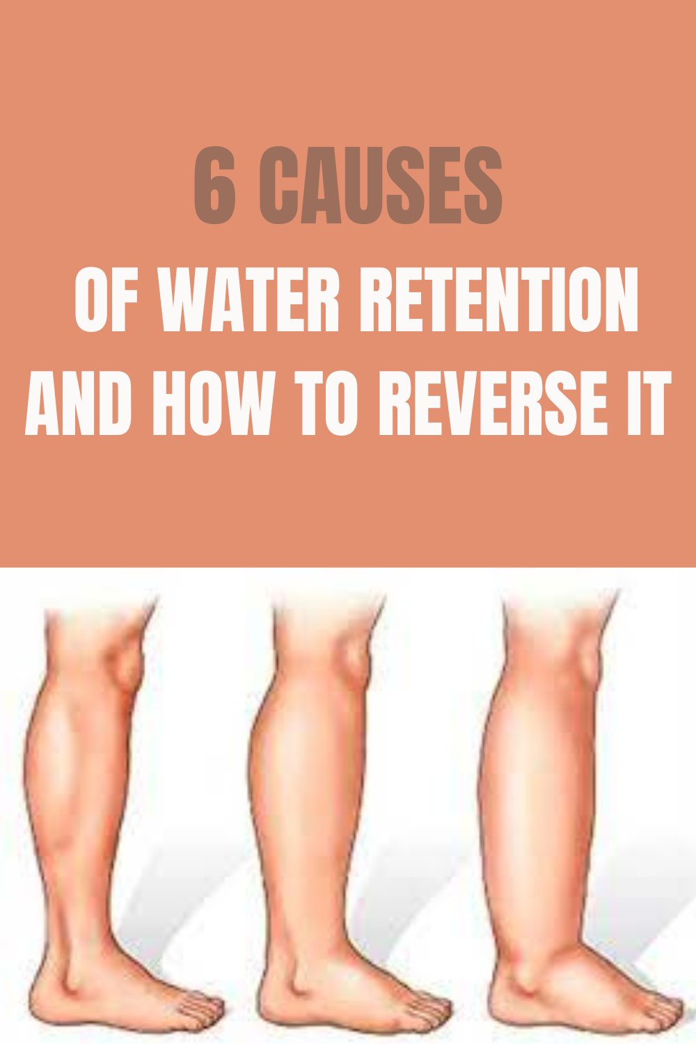 6 Causes of Water Retention and How to Reverse It - Daily Gardening Mag