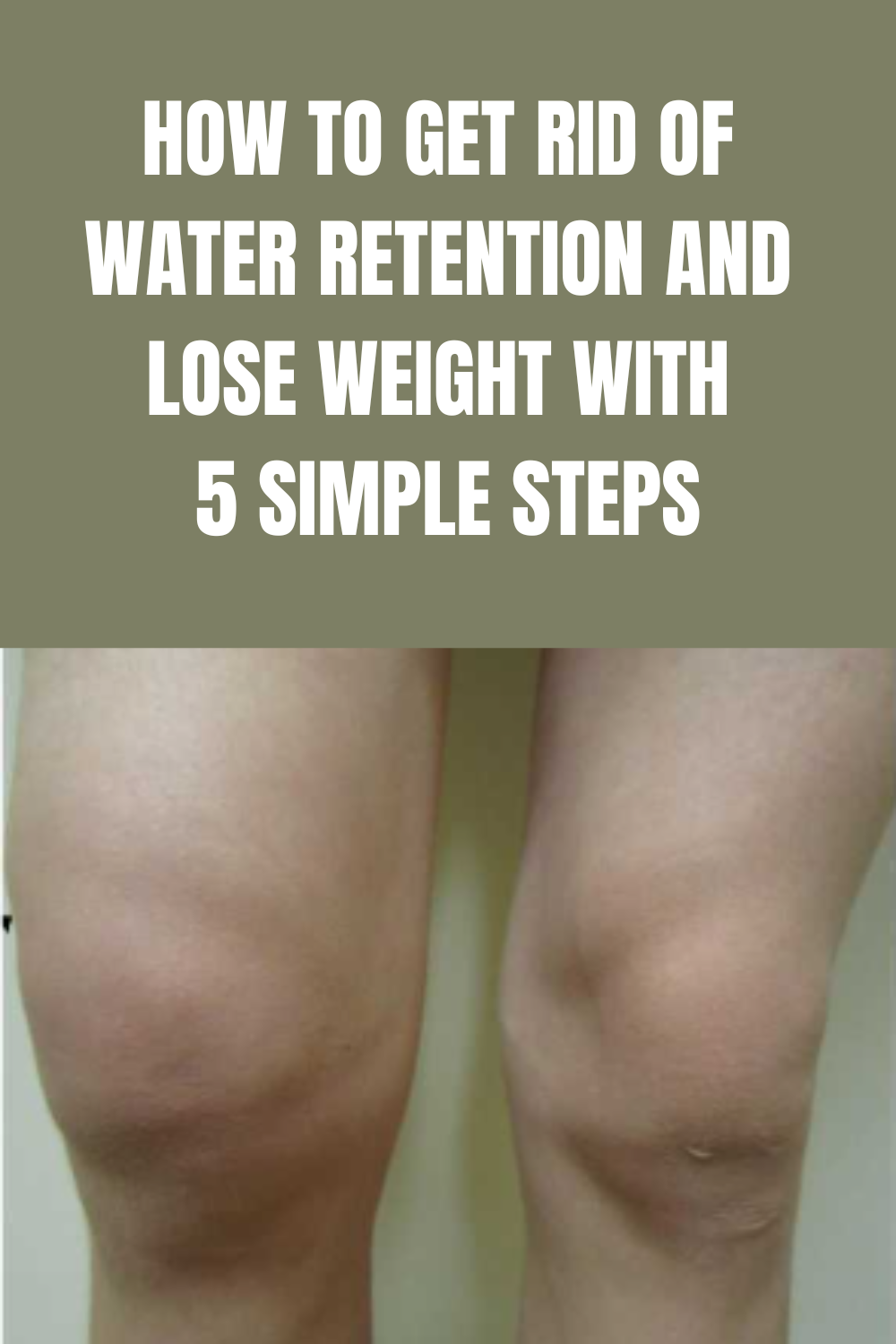 How to Get Rid of Water Retention and Lose Weight With 5 Simple Steps ...