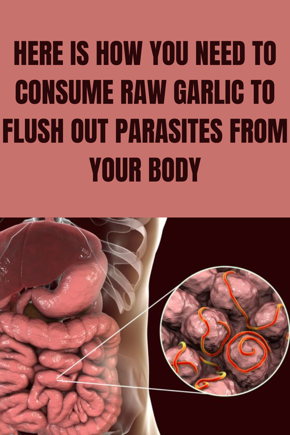 Here is How you Need to Consume Raw Garlic To Flush Out Parasites From ...